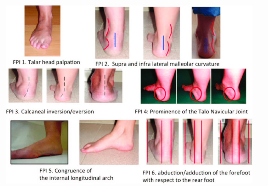 なんでFPIが大事なの？ | JPA足病学ブログ
